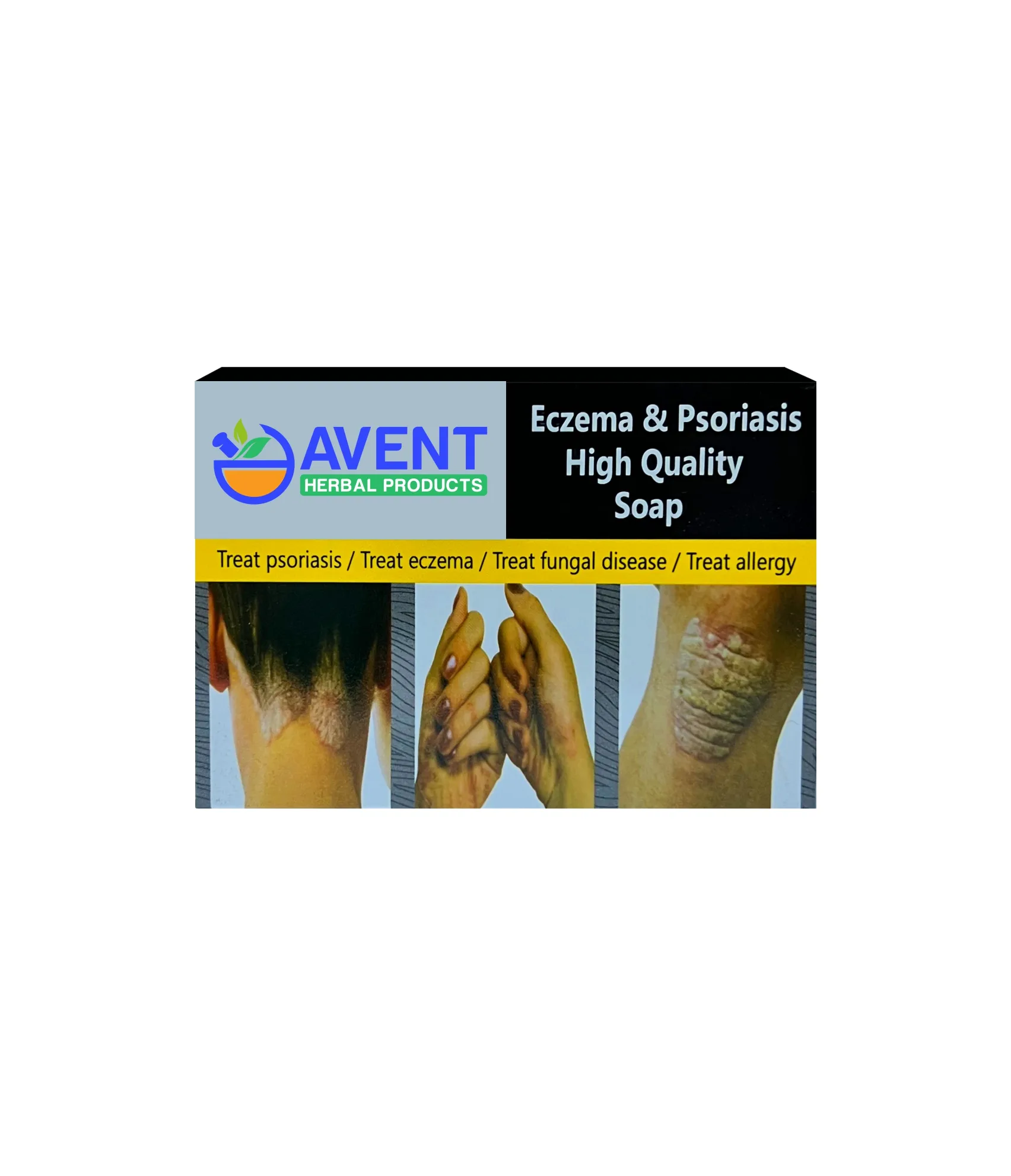 Powerful Eczema and Psoriasis Soap for Skin Relief